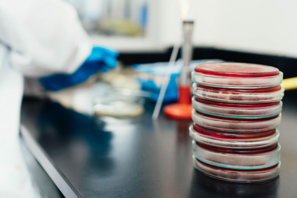 Legionella Testing - Test Water for Legionella Control & Analysis